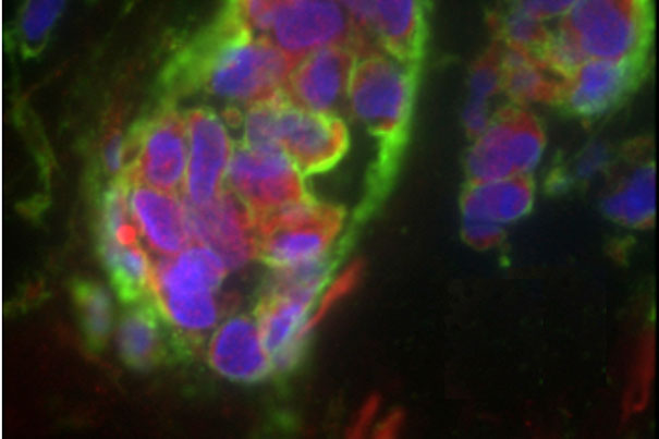 Noncancerous cells carry weight — Harvard Gazette